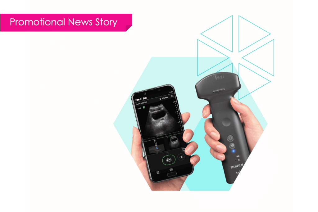 Fujifilm Healthcare launch the latest generation of handheld ultrasound ...