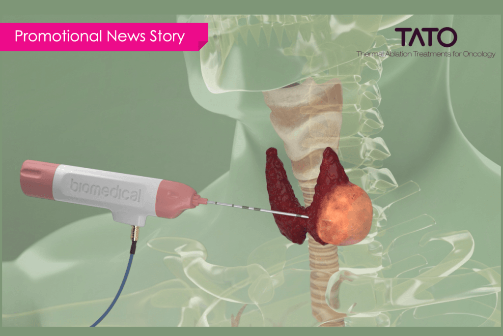 NICE publishes a guidance supporting the use of percutaneous ultrasound ...