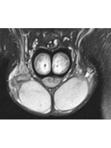 MRI for acute penile imaging - RAD Magazine - The voice of medical ...