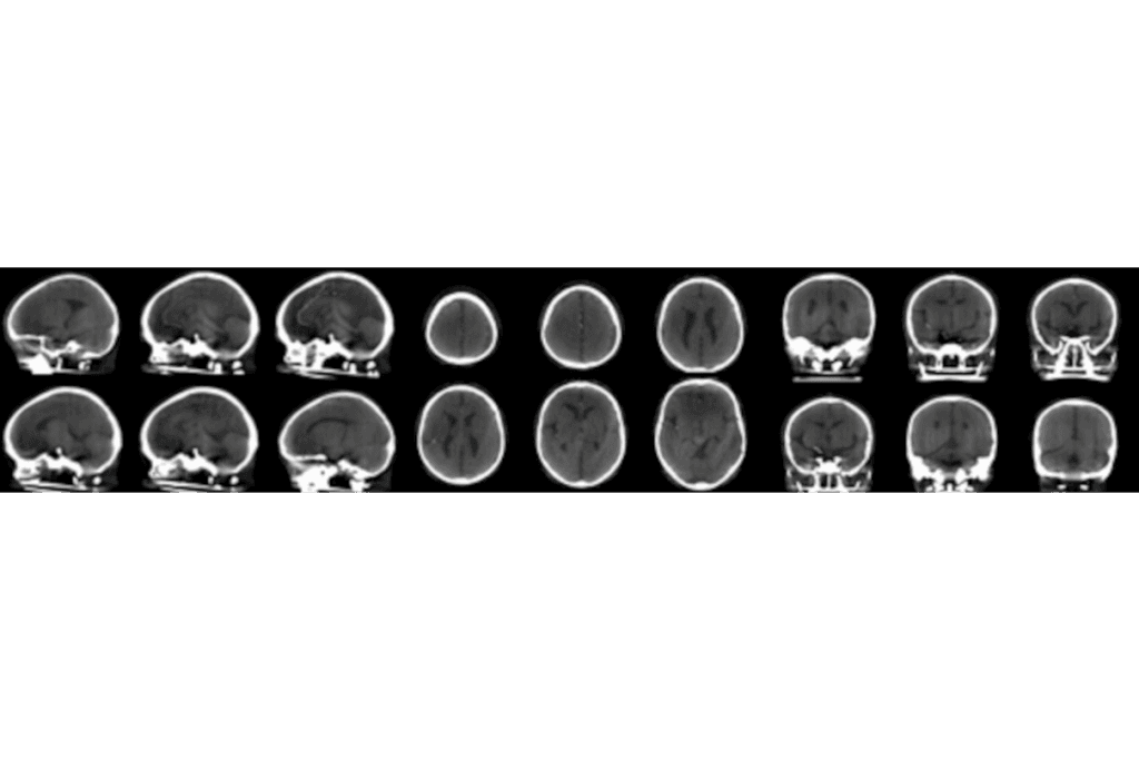 Head CT device delivers first full 3D images - RAD Magazine - The voice ...
