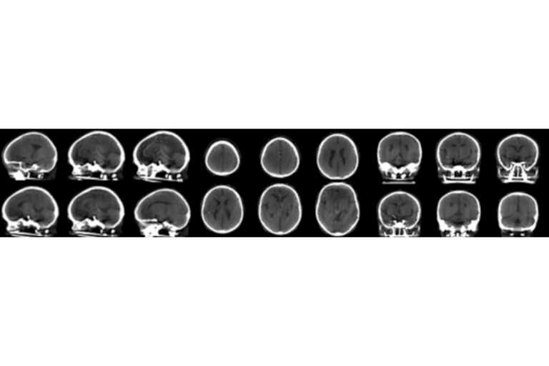 Head CT device delivers first full 3D images - RAD Magazine - The voice ...