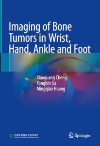Imaging of Bone Tumors in Wrist, Hand, Ankle and Foot - RAD Magazine ...