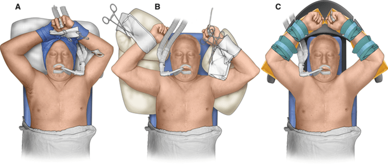 How arm positioning can reduce radiation dose and improve imaging ...