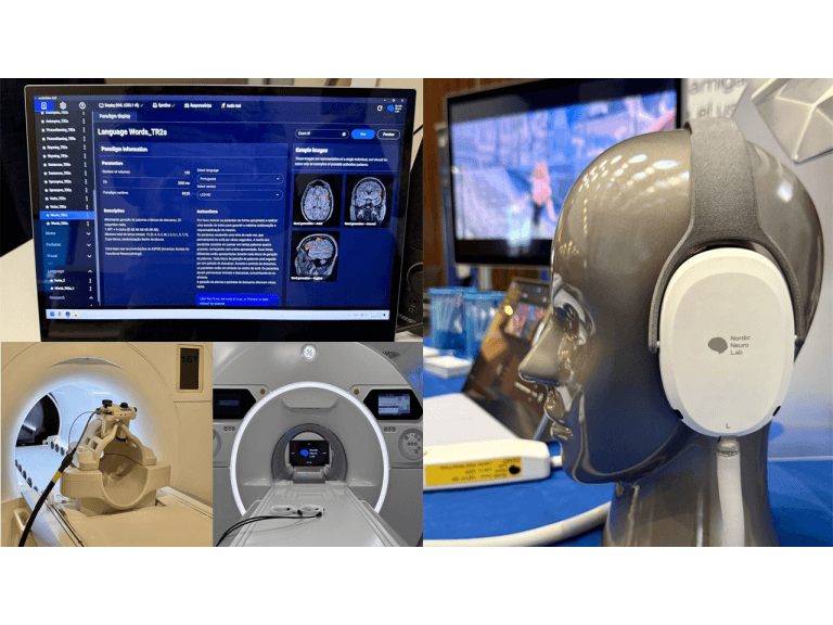Vision RT reaches milestone of 2,000 SGRT systems in clinical use - RAD ...