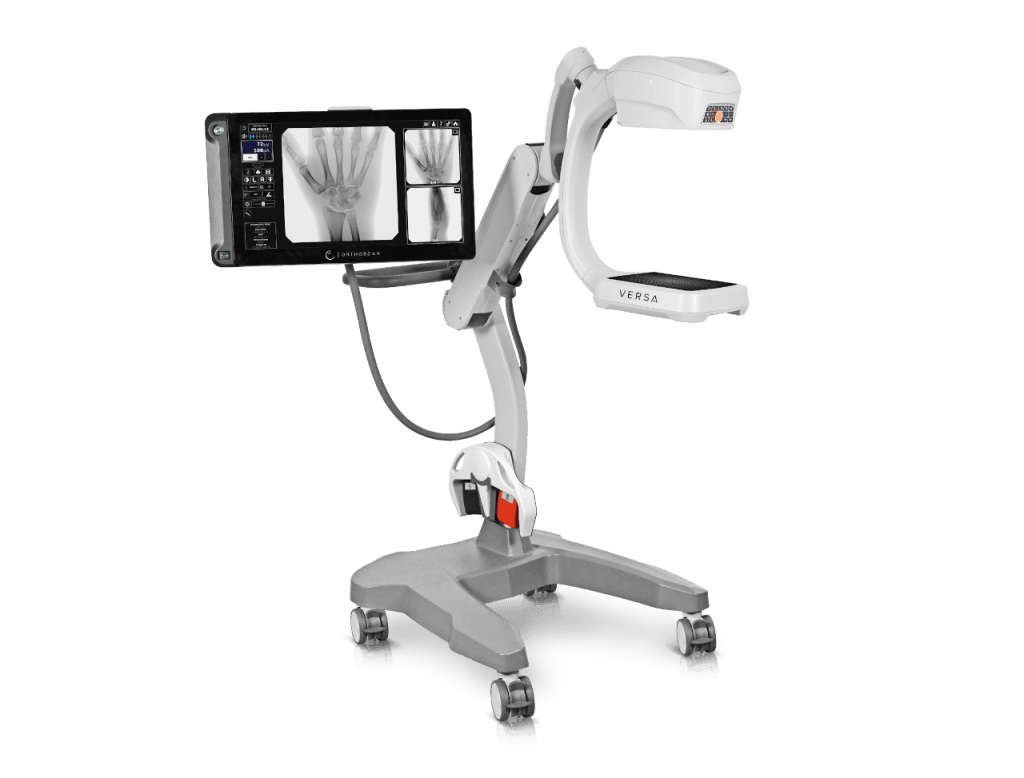 Orthoscan Versa brings extremity imaging closer to care in the NHS ...